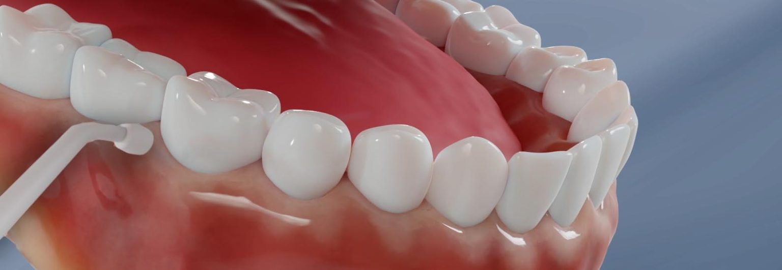 Beyond Brushing: How to Floss with Proper Technique - Bethany Family ...